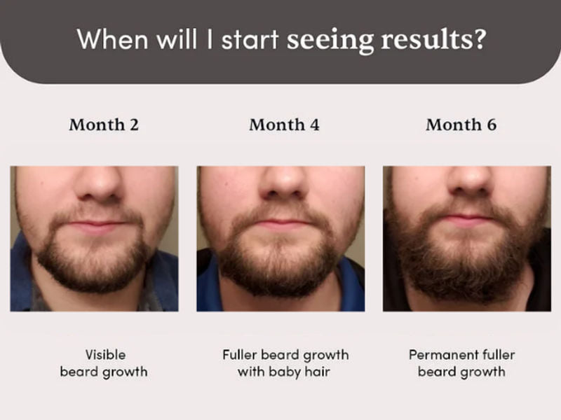 Buy Oral Minoxidil for Beard Growth
