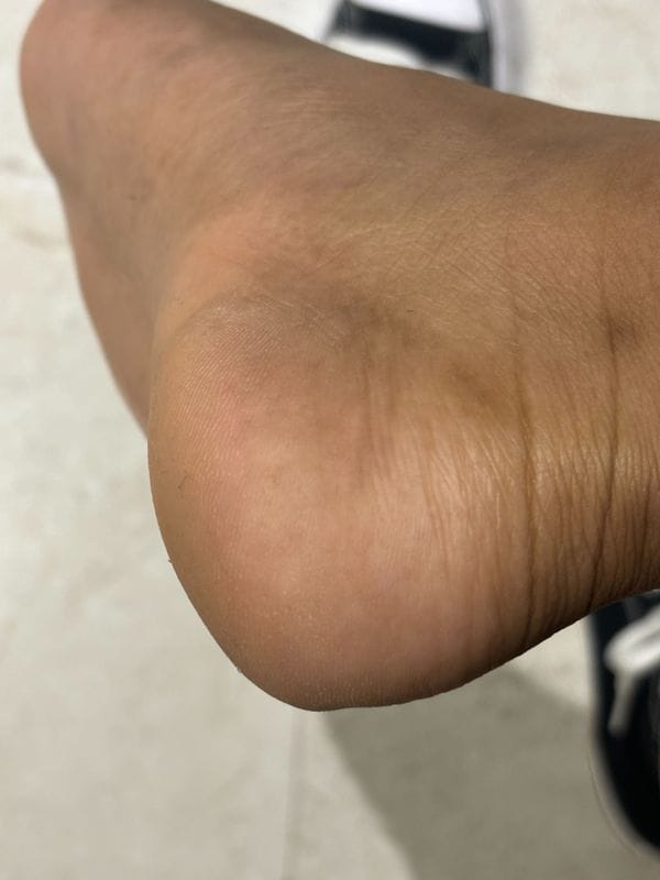 Be Bodywise 20% Urea Foot Roll On - 50 ml Ratings & Reviews