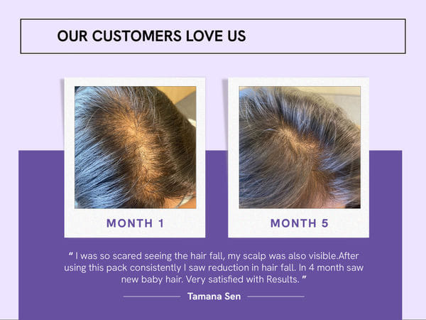 Buy Hair Growth Pack For Women - Bodywise