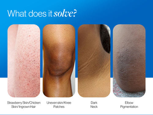 Buy Body Exfoliation & Pigmentation Kit For Women - Be Bodywise
