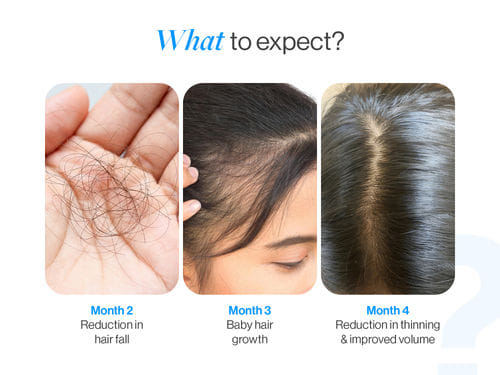 Buy Bodywise Folli Advanced+ Hair Growth Serum Roll On with Redensyl ...