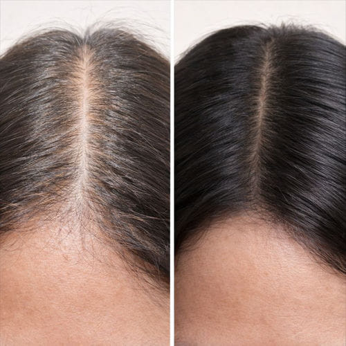 Buy Bodywise Folli Advanced+ Hair Growth Serum Roll On with Redensyl ...