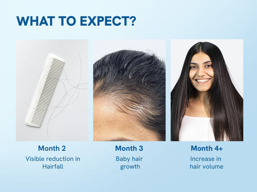 Buy Hair Growth Pack For Women - Bodywise