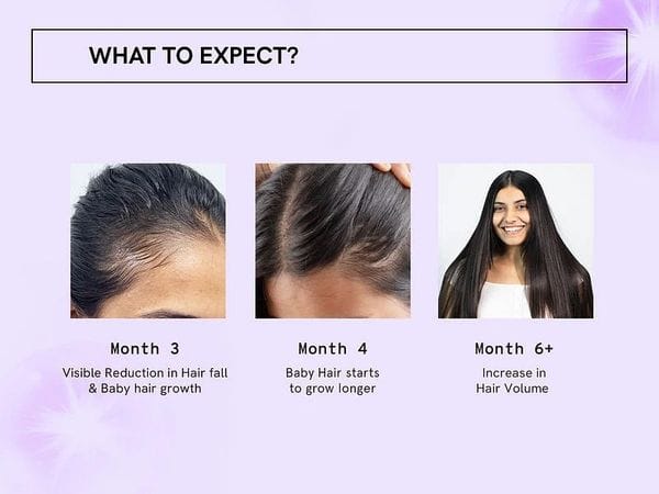 Buy Hair Growth Pack For Women - Bodywise
