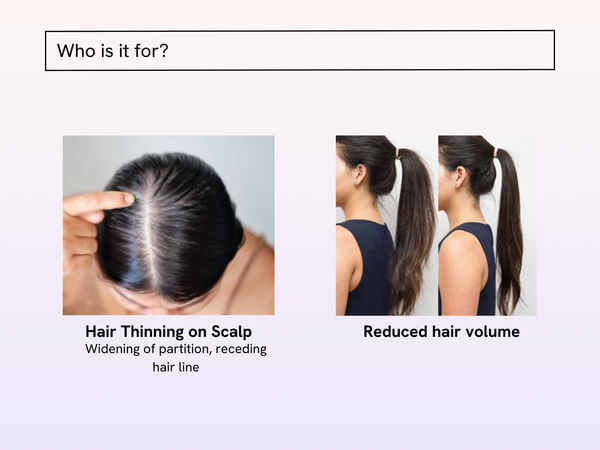 Hair Growth Serum with Redensyl, Procapil, Baicapil (Paraben Free)