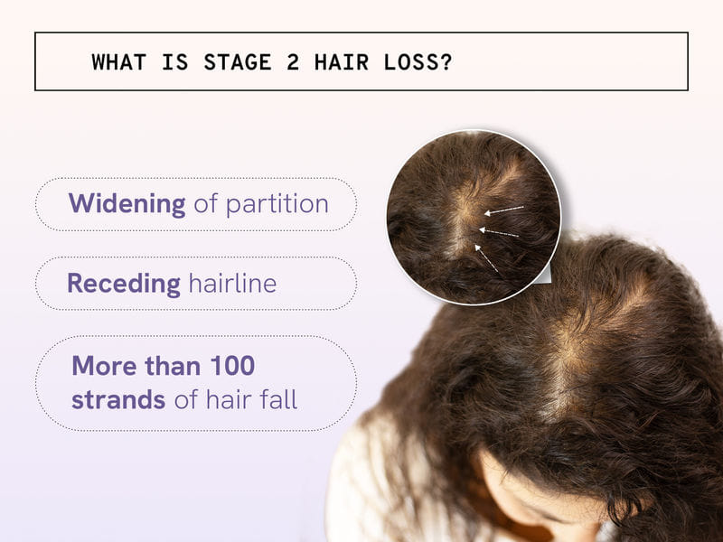Buy Hair Growth Pack for Post-Pregnancy Hair Loss (1 month) - Be Bodywise