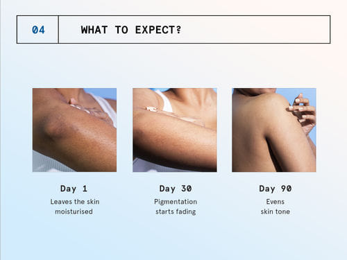 Buy Pigmentation Repair Cream