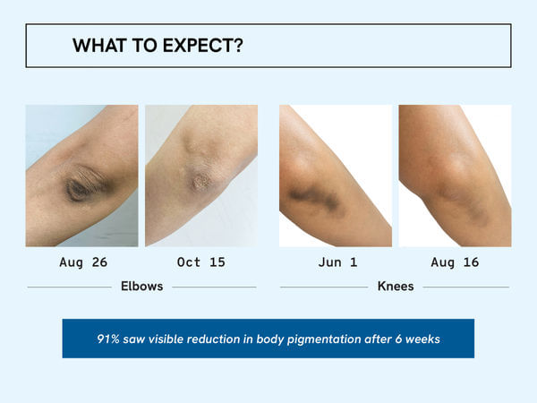 Buy Pigmentation Repair Cream