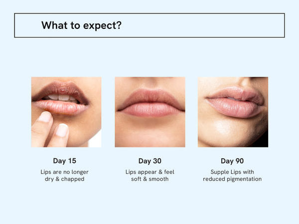 Buy Pigmentation Repair Lip Balm with SPF 30 For Women Clinically ...